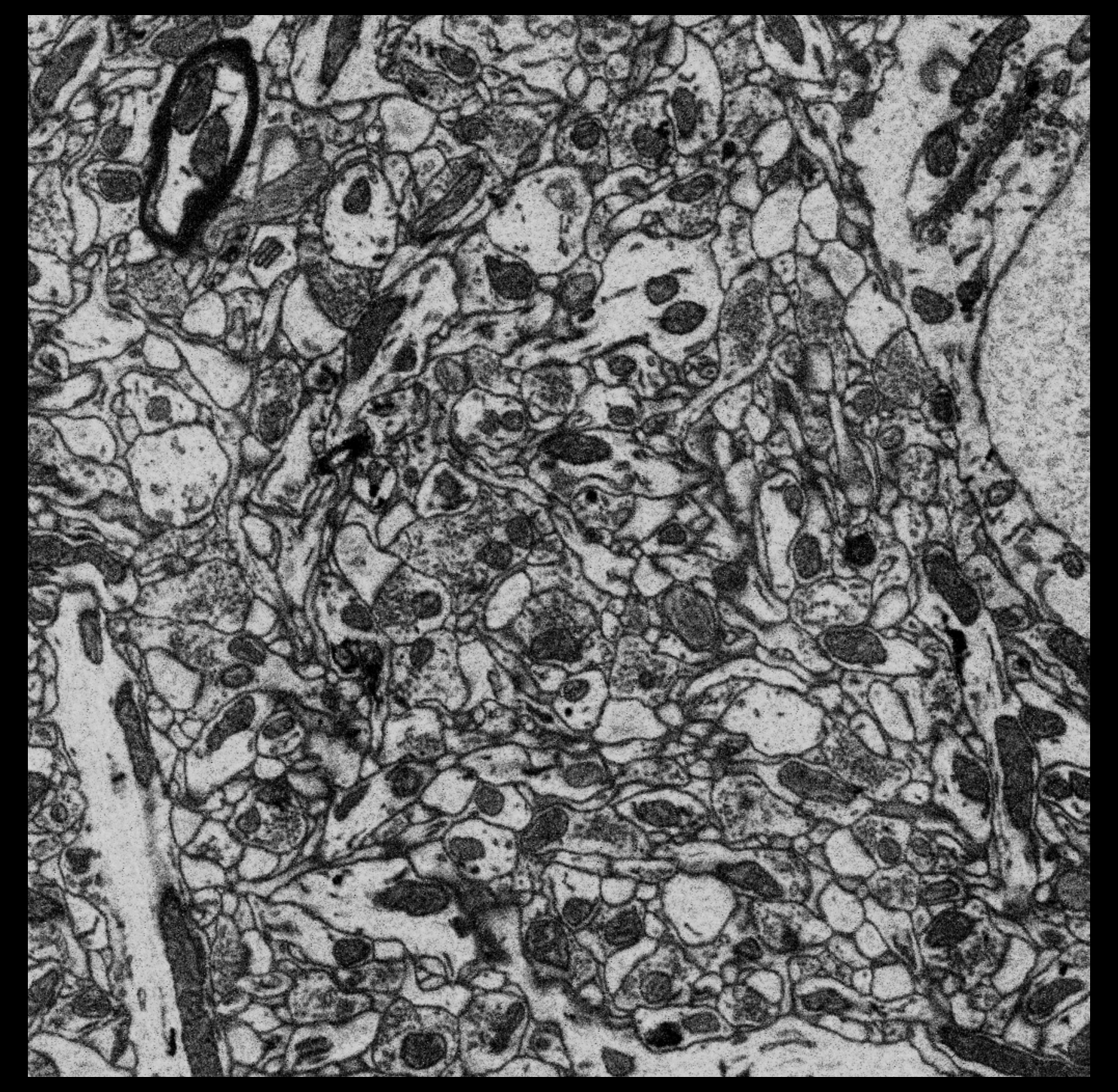 Mouse Brain Electron Microscopy