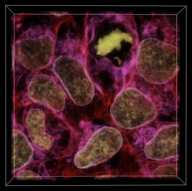 ChimeraX Microscopy Tutorial